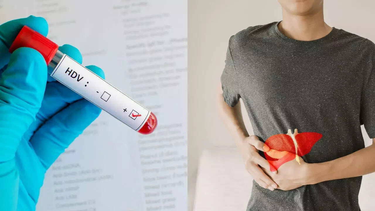 How Hepatitis D virus can cause liver cancer: Know its symptoms, risks ...