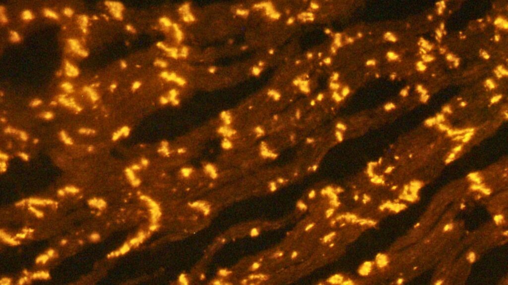 Study Reveals: Humans Give Off Light That Is Extinguished in Death