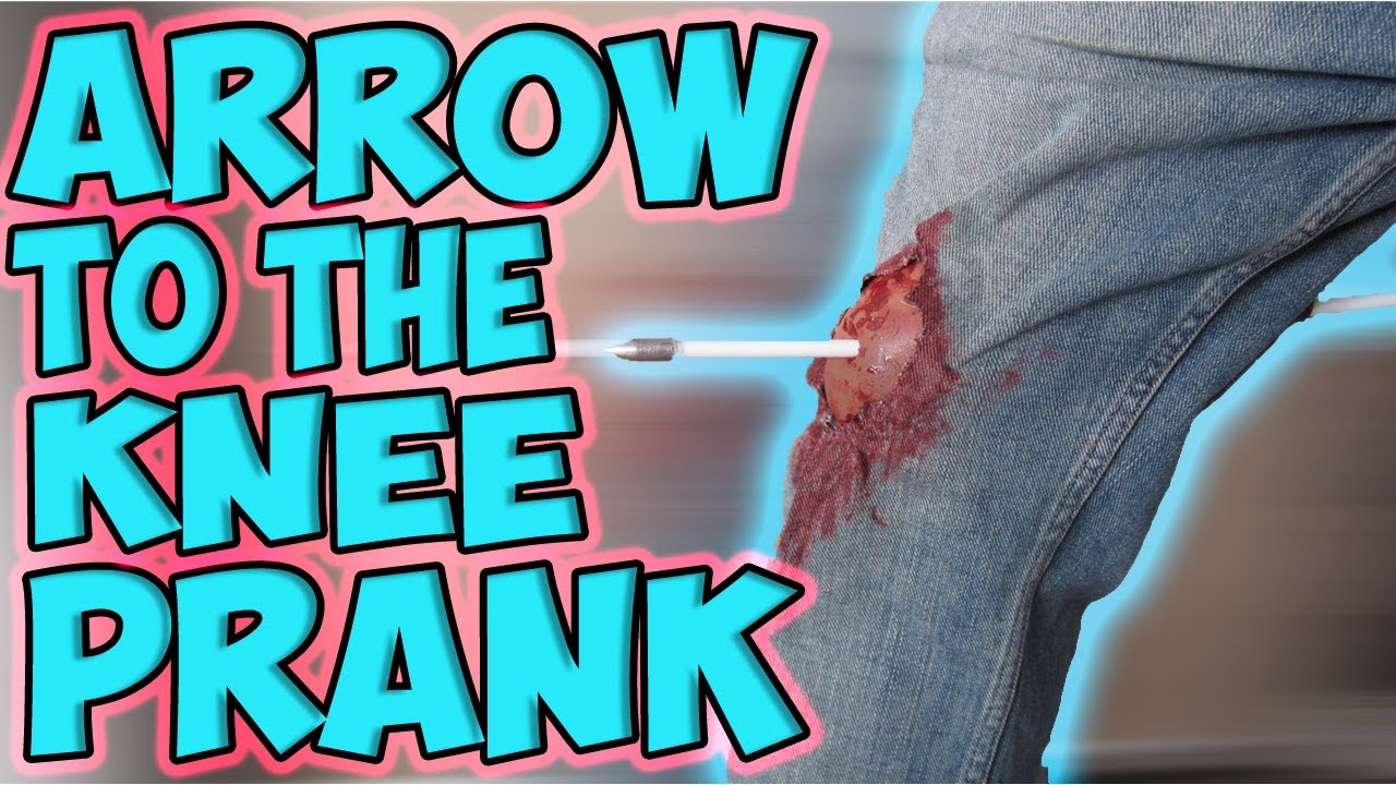 Arrow to the Knee Prank