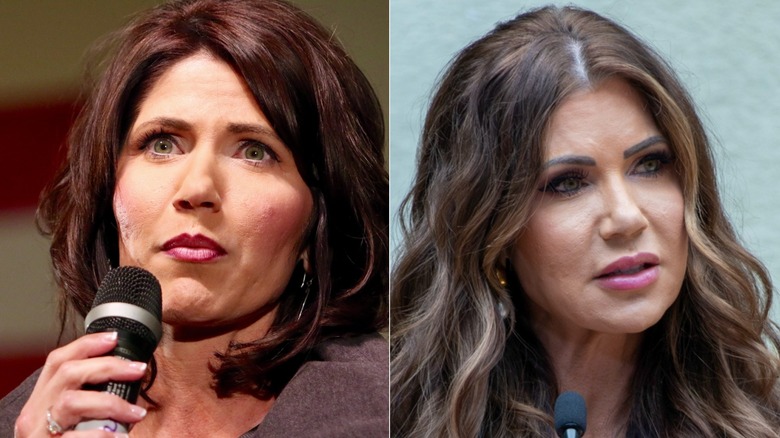 What Kristi Noem's Lips Looked Like Before Fillers