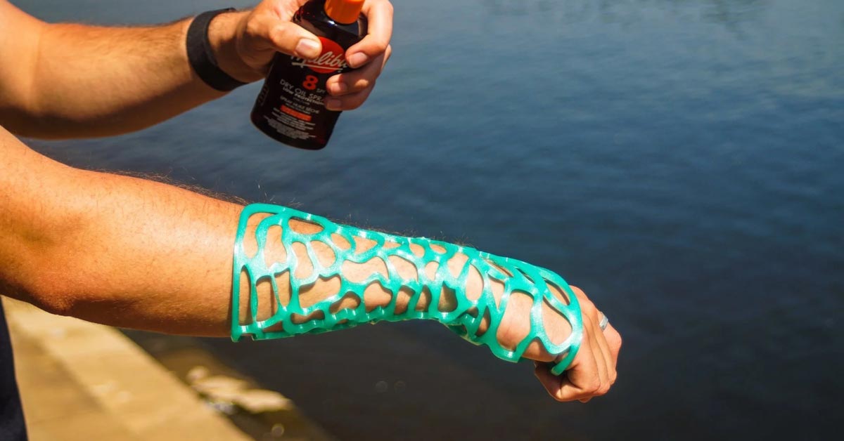 This student's life-changing injury made him realize how 'outdated ...