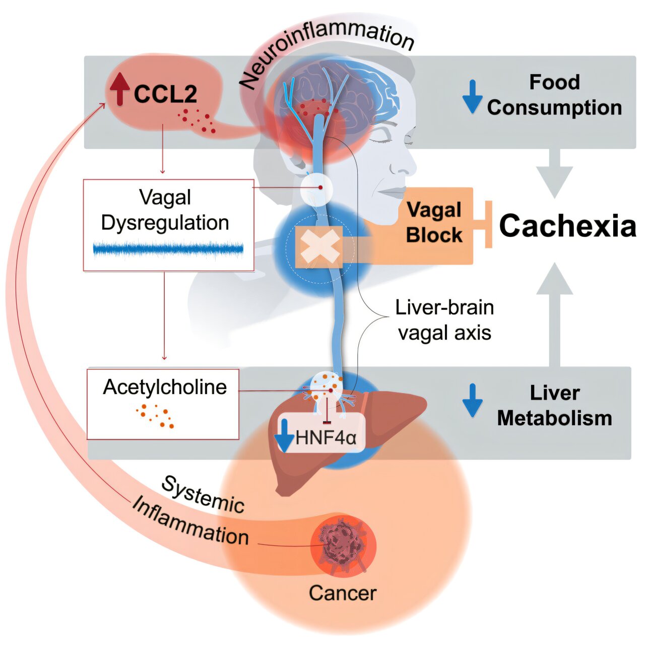 Blocking brain-liver communication may prevent deadly weight loss in cancer