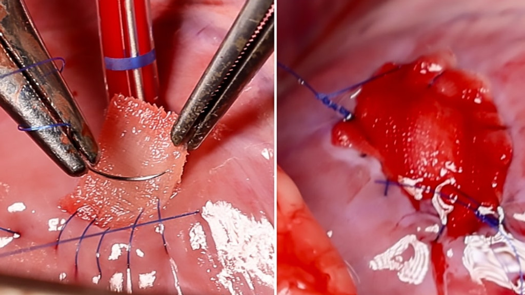 Scientists Create 3d Printed Biological Patch That Can Heal A Broken