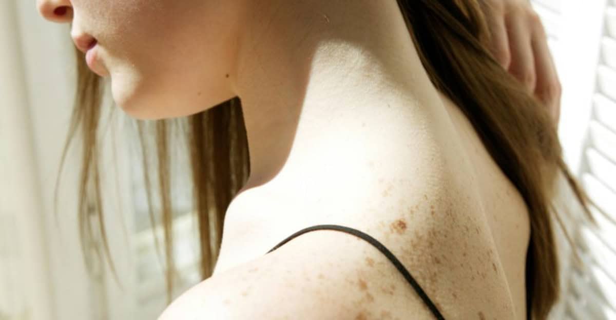 The Spiritual Meaning of Beauty Marks On Your Body