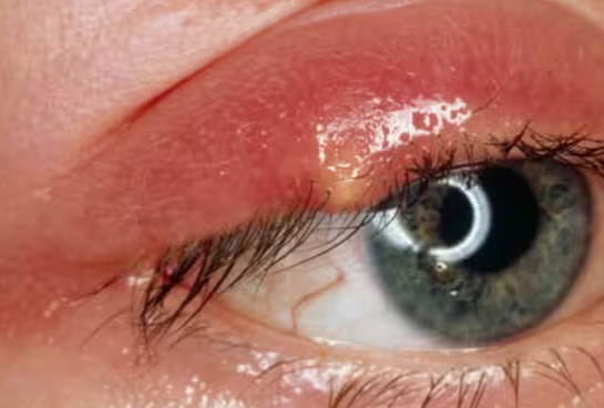 A rapidly growing lump may be a sign of internal cancer. Rush to the ...