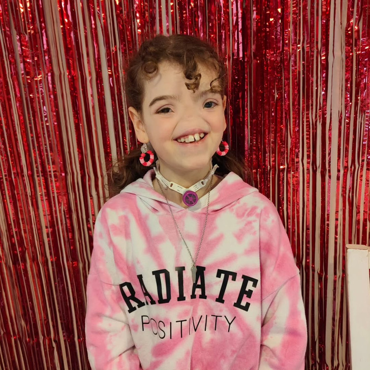 “Voldemort” Baby Grew Up — What She Looks Like Today Will Shock You