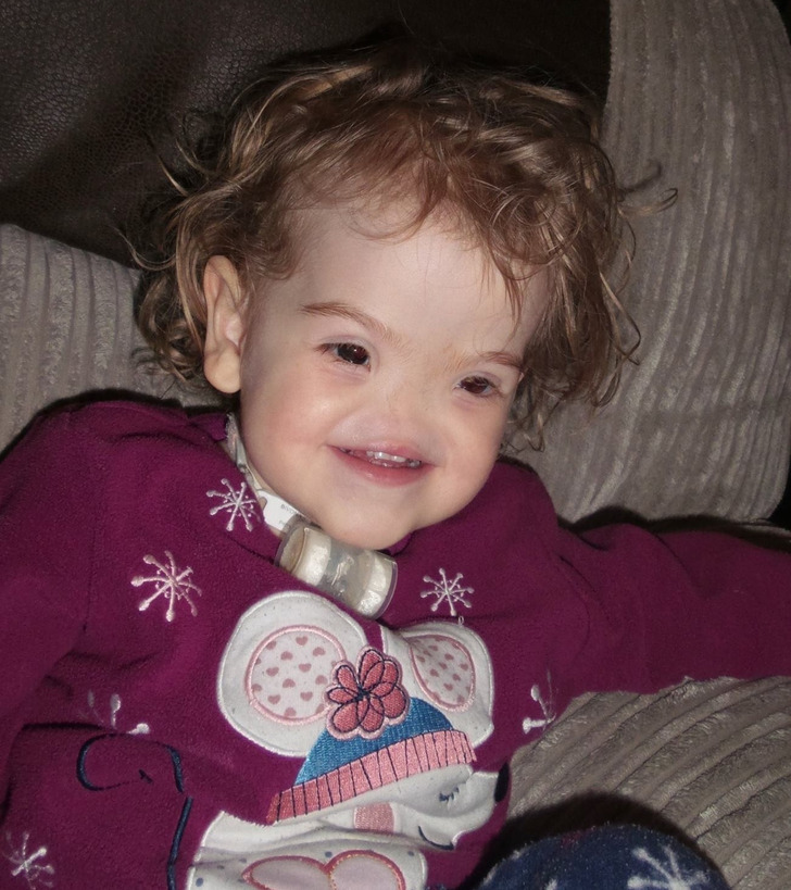 “Voldemort” Baby Grew Up — What She Looks Like Today Will Shock You