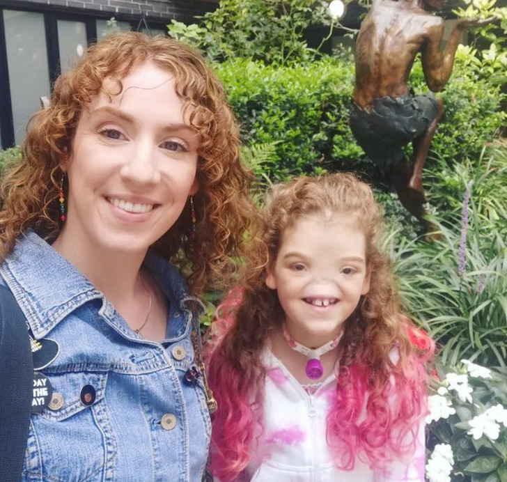 “Voldemort” Baby Grew Up — What She Looks Like Today Will Shock You