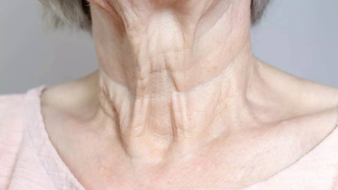 10 natural and simple remedies to treat neck wrinkles at home