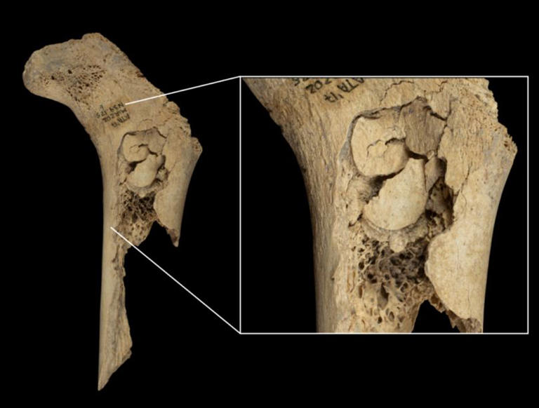 'Extreme exploitation': Spanish archaeologists find signs of war ...