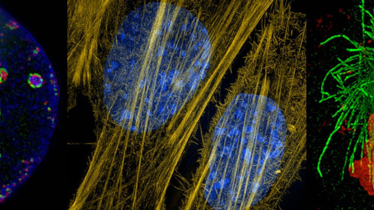 Super-resolution microscopes showcase the inner lives of cells