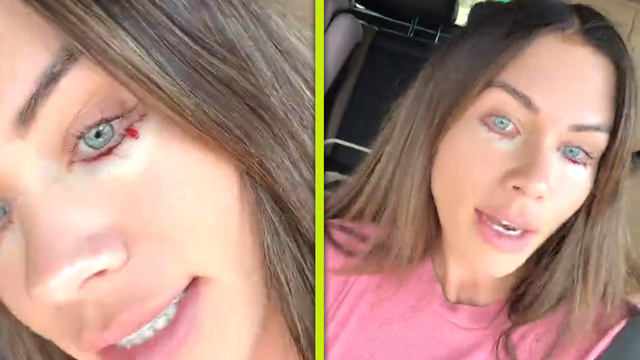 Mormon Wives' Jessi Explains Why Her Eyes Were BLEEDING