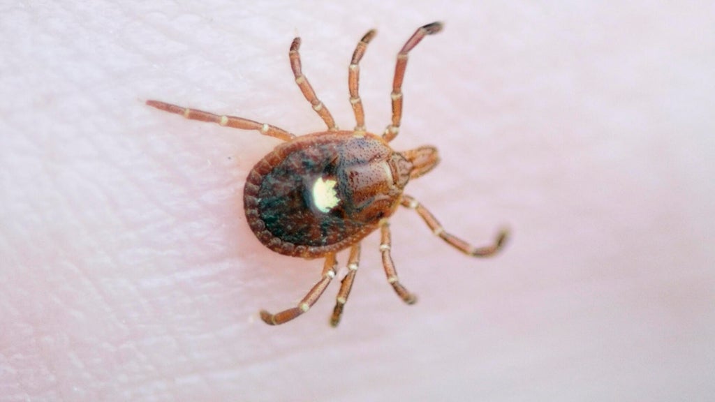 1st death linked to so-called "meat allergy" spread by ticks reported ...