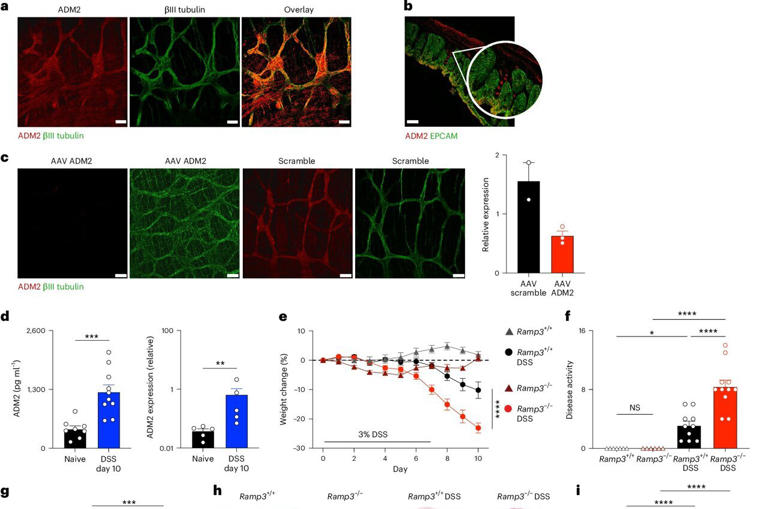 Gut neurons help body fight inflammation with immune-regulating molecule