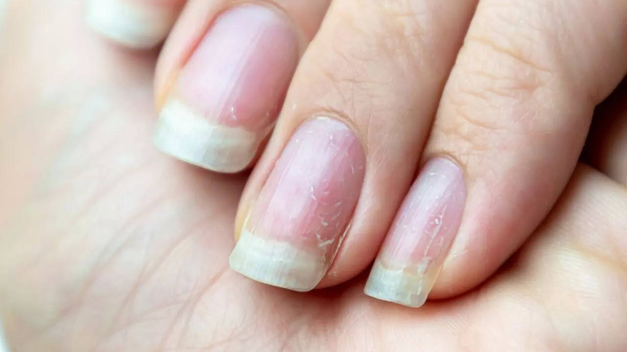 How your fingernails can signal serious health conditions like heart ...
