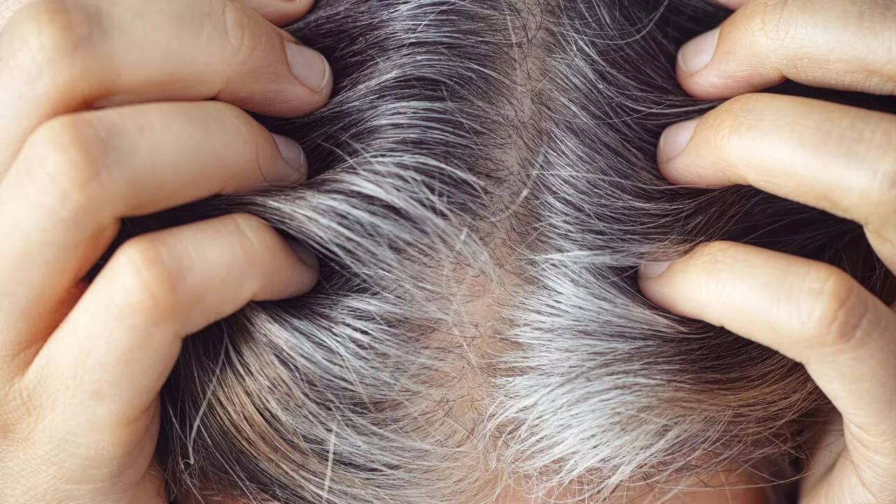Is grey hair warning of thyroid, heart, and nutrient issues: How ...
