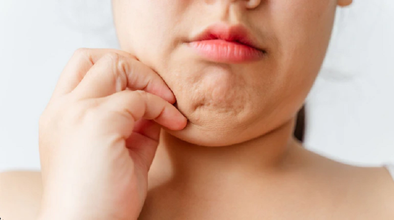 Your double chin is not reducing even after a lot of effort? These easy ...