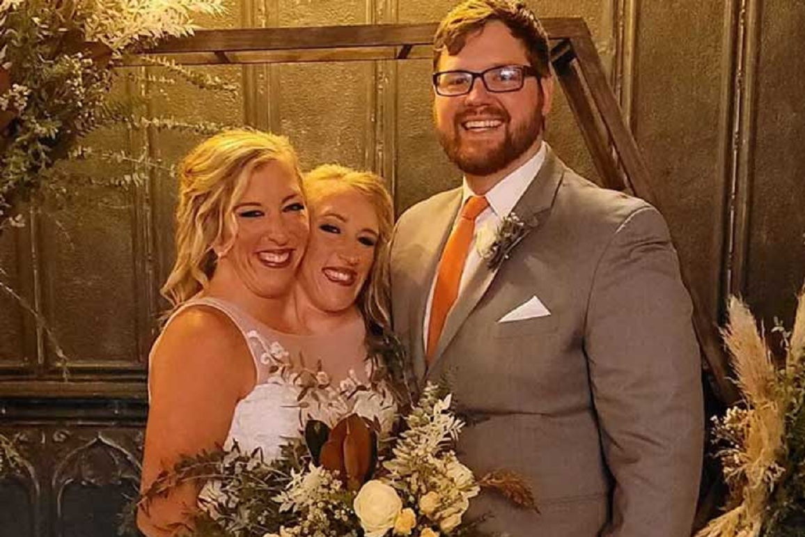 Conjoined Twins Abby and Brittany Hensel Spotted Carrying Newborn Baby ...