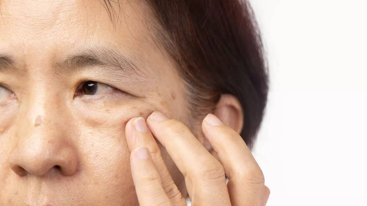 Eye twitching be a sign of an eye stroke; know the early signs
