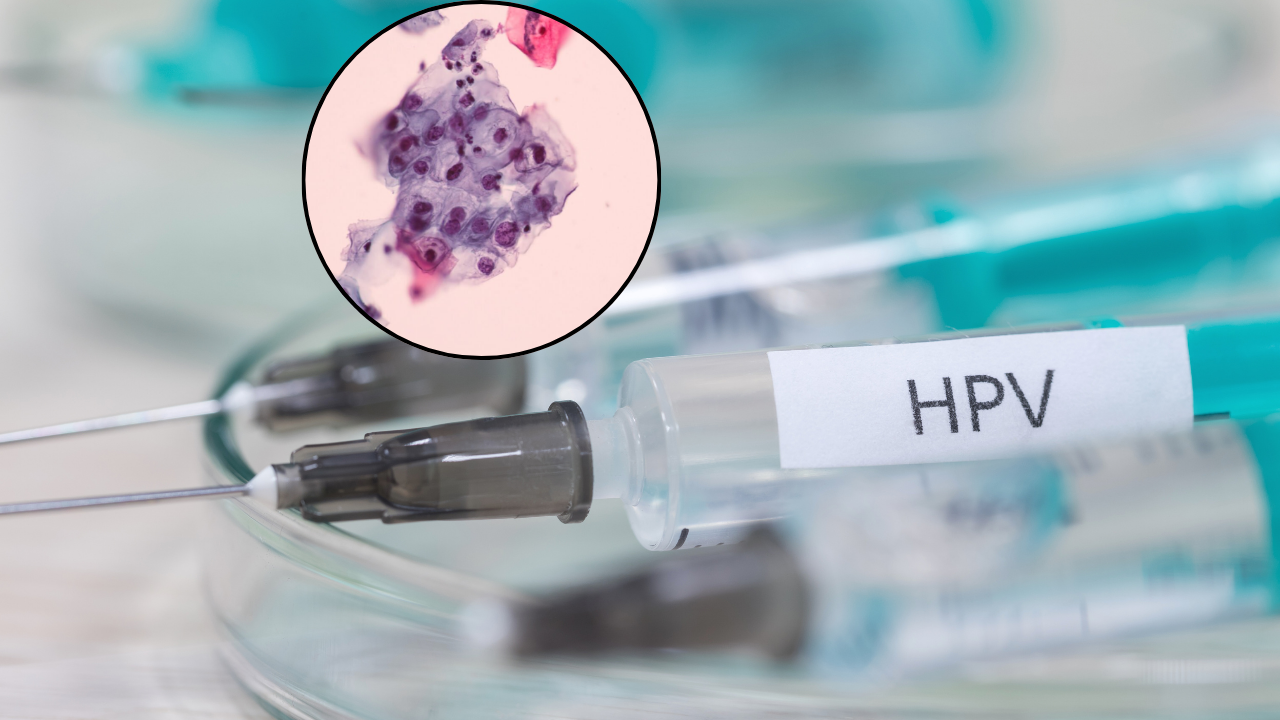 A Common Virus Behind Thousands Of Cancer Cases, But Why Most Americans ...