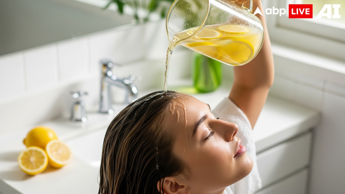 Say Goodbye To Dandruff With These 8 Natural Home Remedies