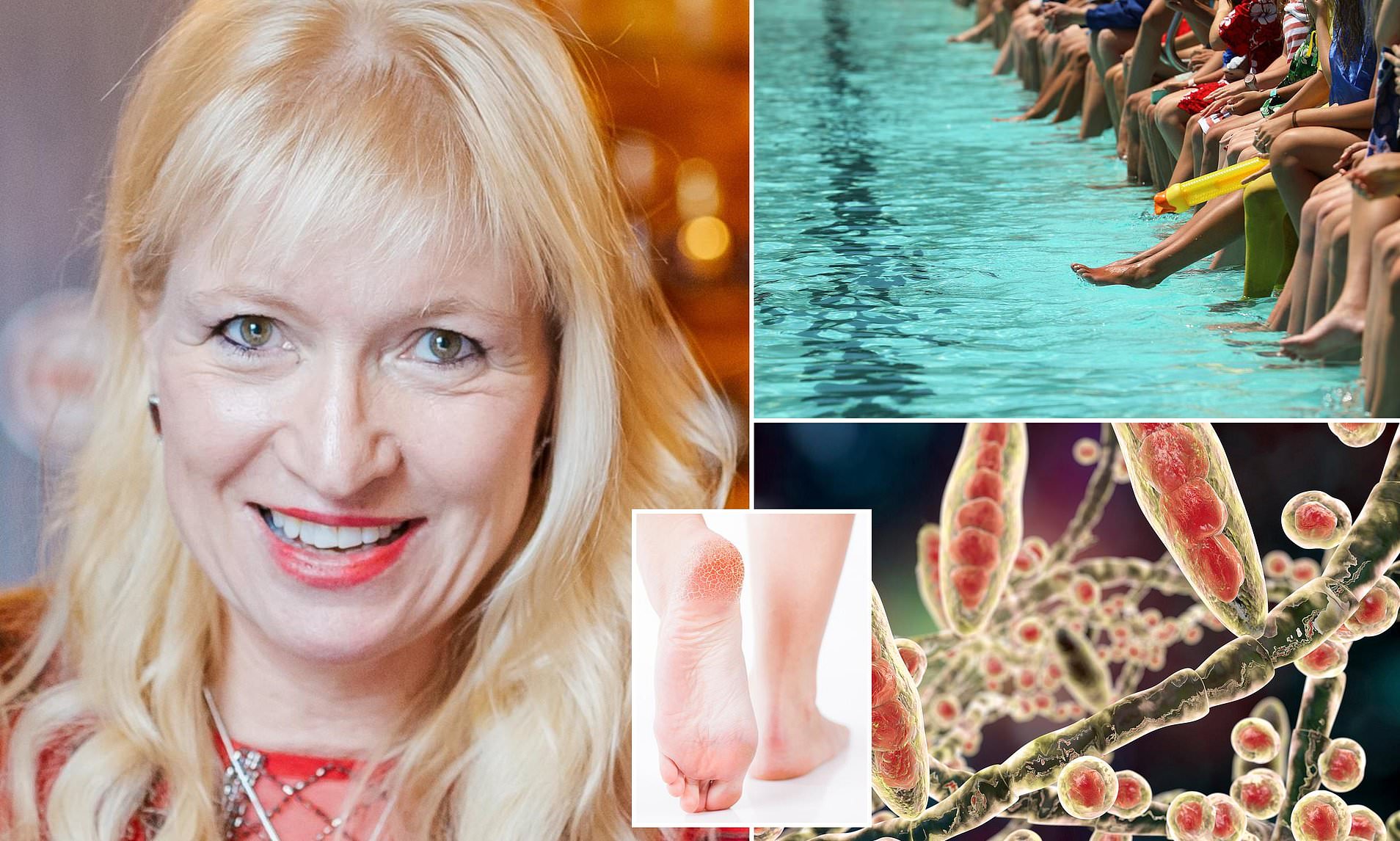 You should NEVER ignore crusty, white heels: GP explains why this isn't ...