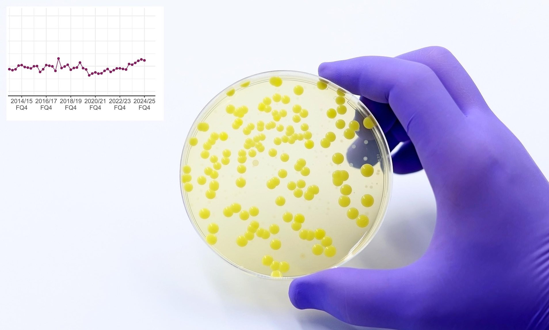Brits warned against sharing towels after spike in MRSA superbug infections
