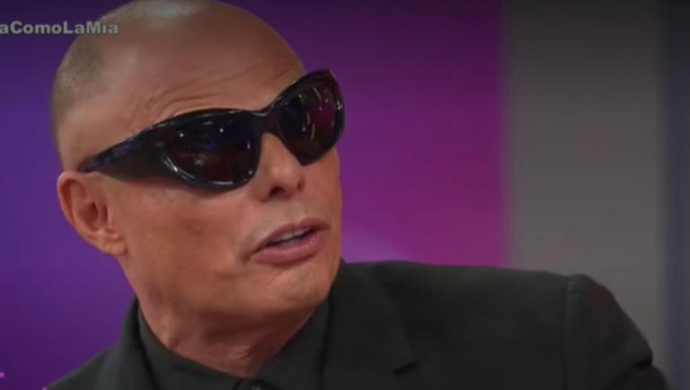 Claudio Yarto, ex integrante de Caló, revela por qué siempre usa lentes ...