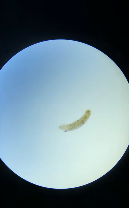Baby Snail Under The Microscope