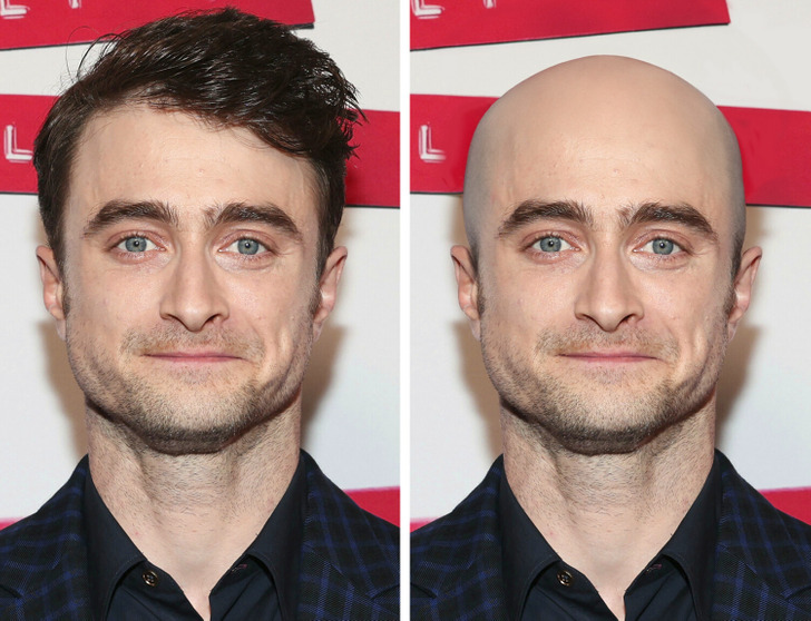 We Imagined 14 Celebrities Bald — And the Results Are Really Impressive