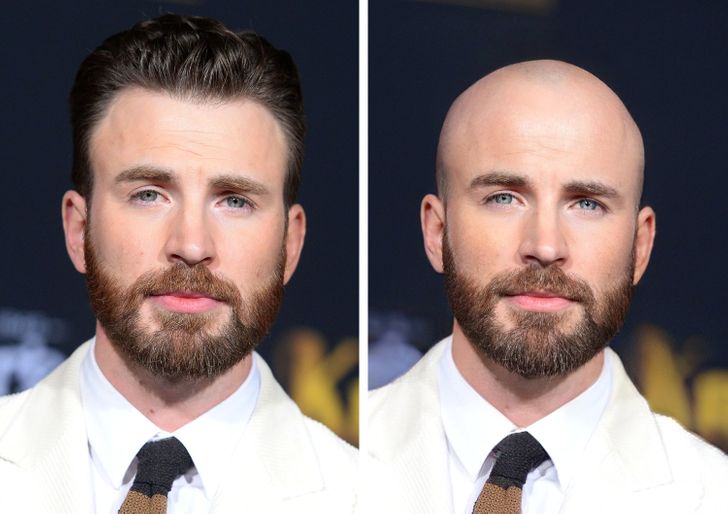 We Imagined 14 Celebrities Bald — And the Results Are Really Impressive