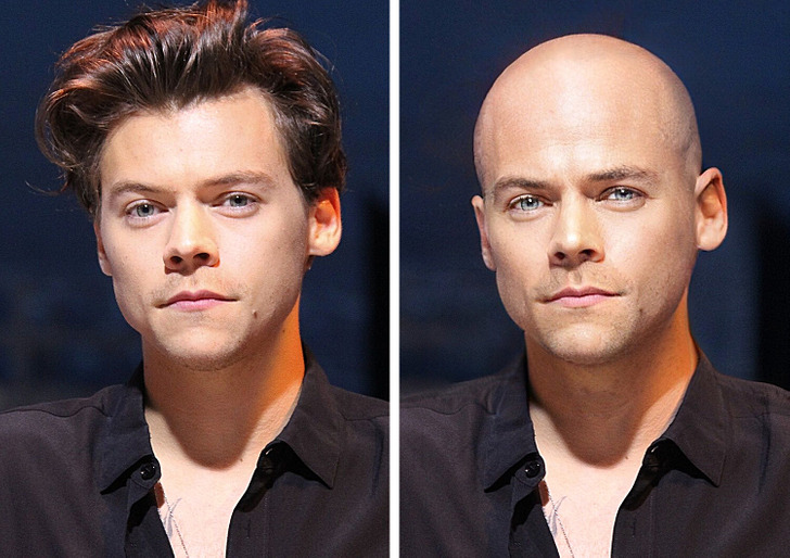 We Imagined 14 Celebrities Bald — And the Results Are Really Impressive