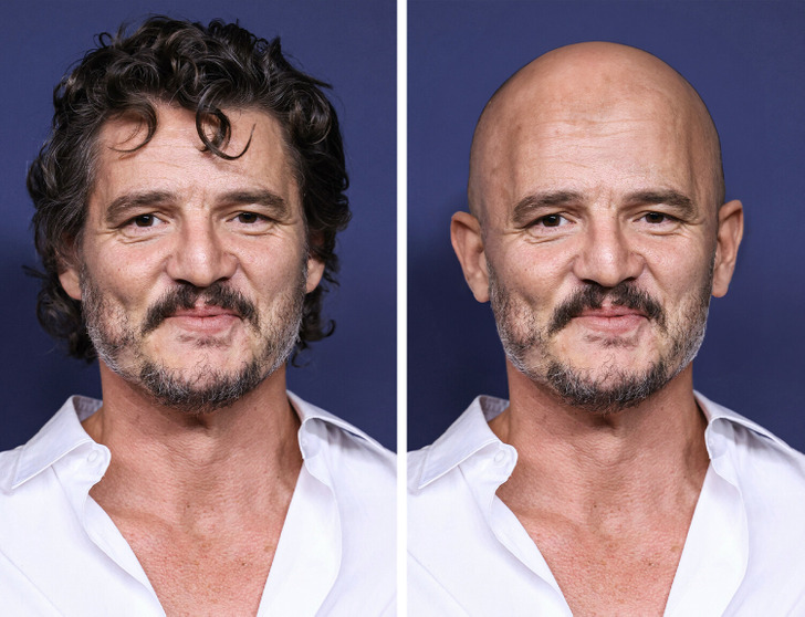 We Imagined 14 Celebrities Bald — And the Results Are Really Impressive