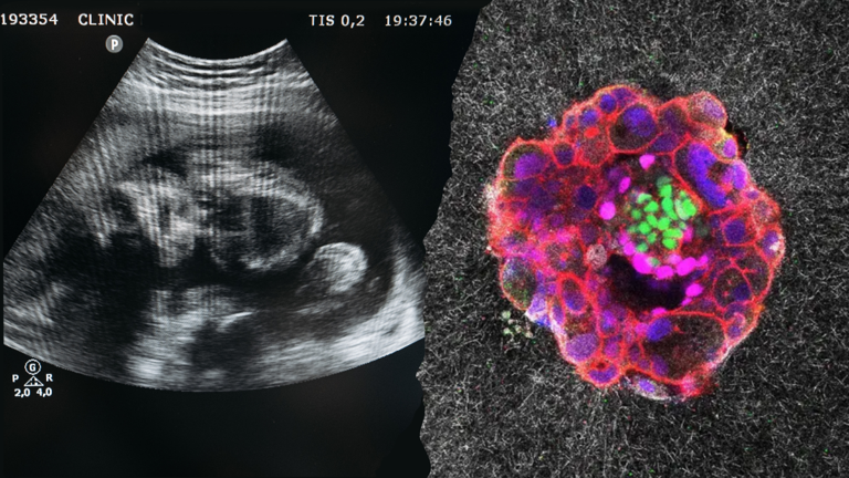 Watch: The Exact Moment A Human Embryo Implants In Real-Time