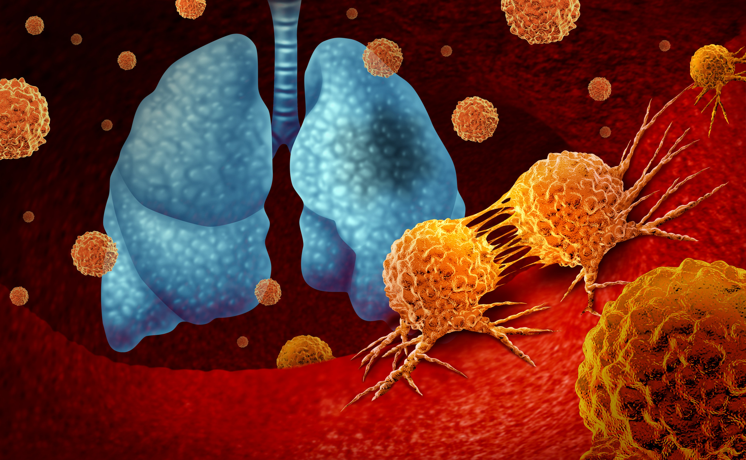 Early warning sign for aggressive cancers discovered
