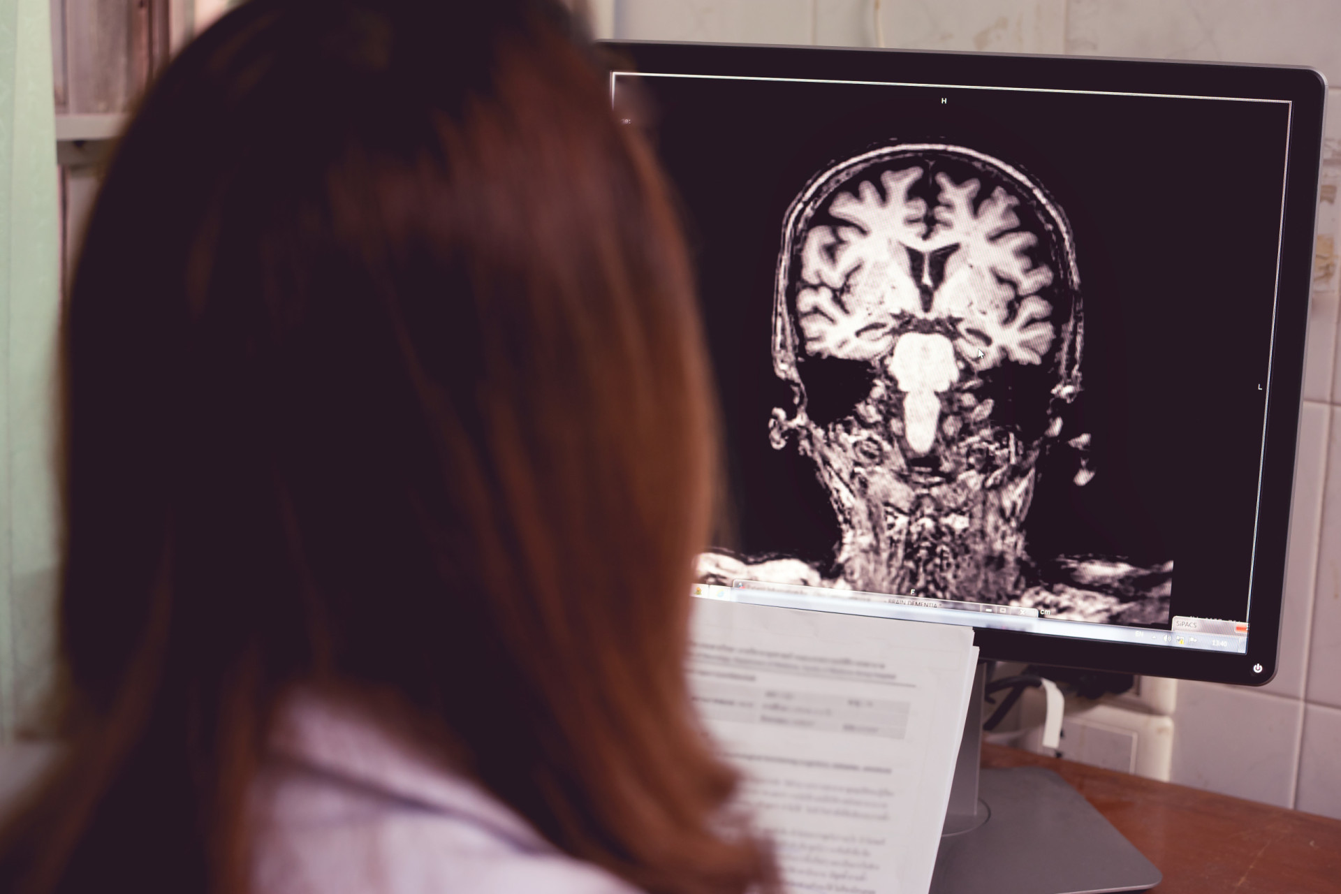 Tu cerebro comienza a mermar después de los 40: esto es lo que debes hacer