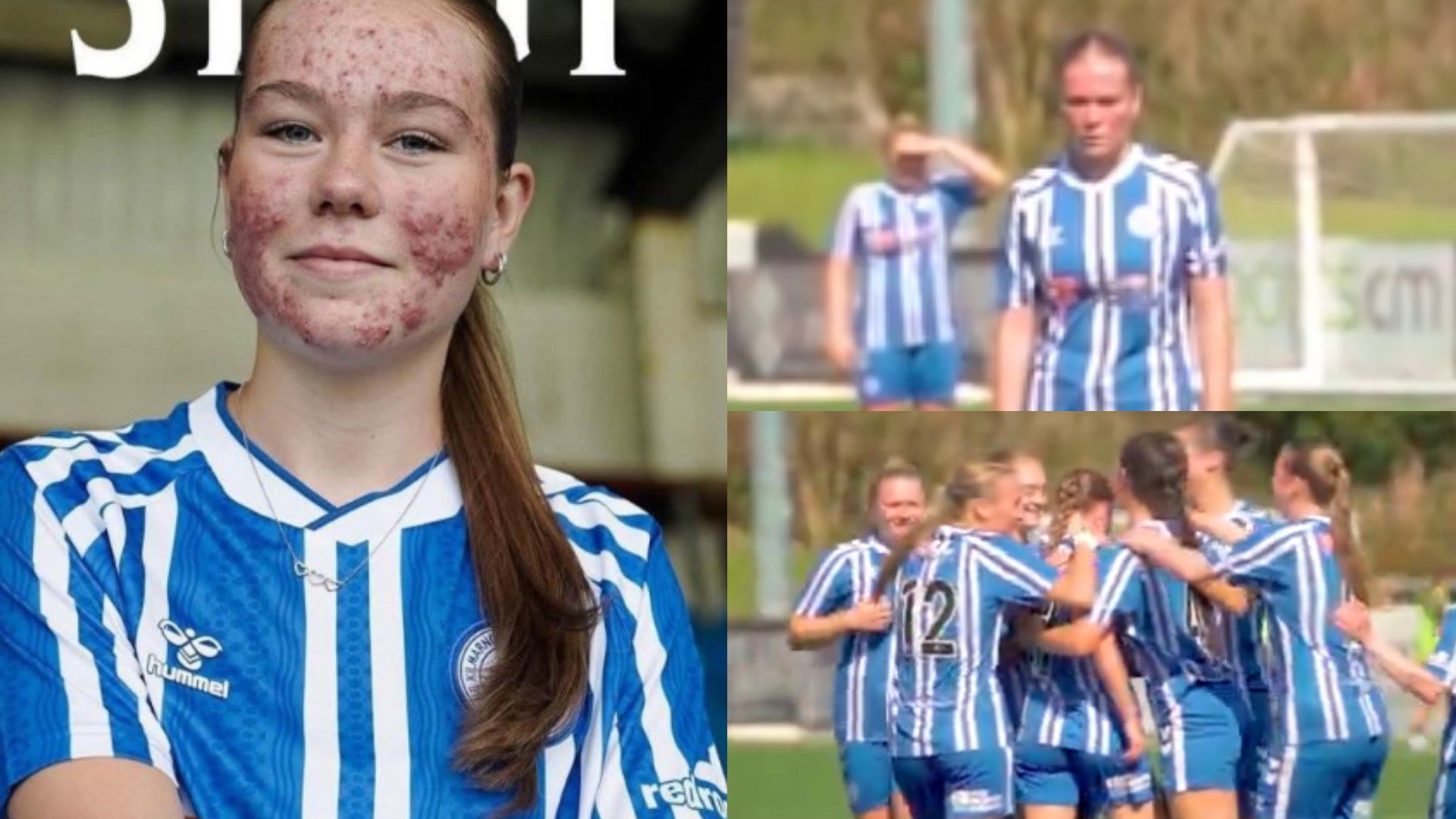 📽️ | Teen scores unreal free-kick after receiving online abuse