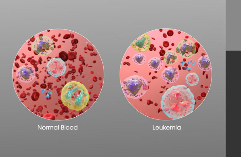 'We were not aware Gazan woman had leukemia,' says BBC after claiming ...