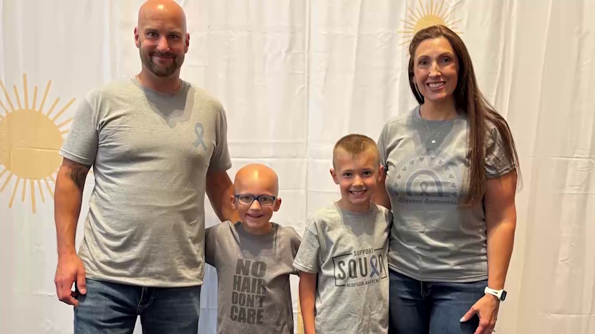 Mass. community supports 5-year-old with alopecia