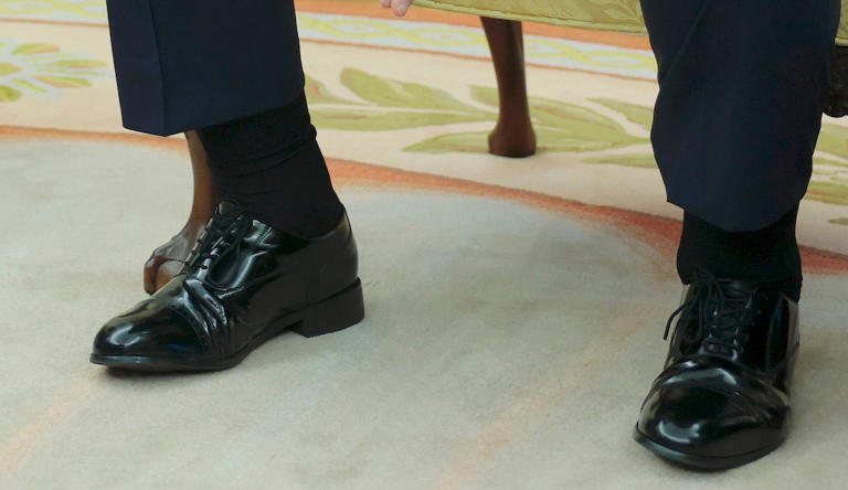 Trump's Limbs Are Looking Awfully Swollen