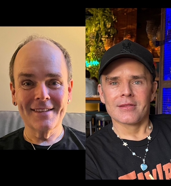 This Man's Mexico Facelift Has Everyone's Jaws On The Floor, And Over 6 Million People Can't ...