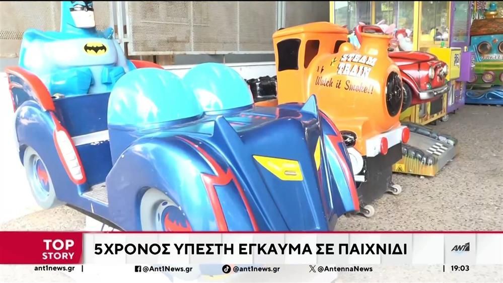 Θεσσαλονίκη: 5χρονος έπαθε έγκαυμα σε παιδικό παιχνίδι