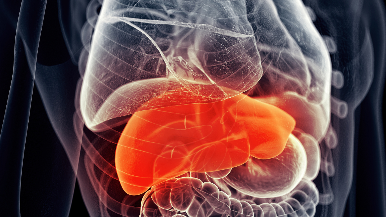 How to reverse fatty liver in just 90 days: Small daily changes that ...