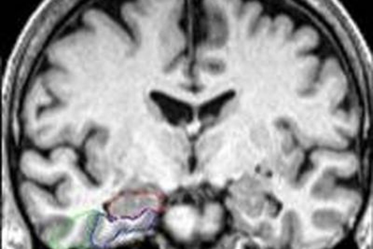 Scientists discover natural compounds found in popular hot drink that ...