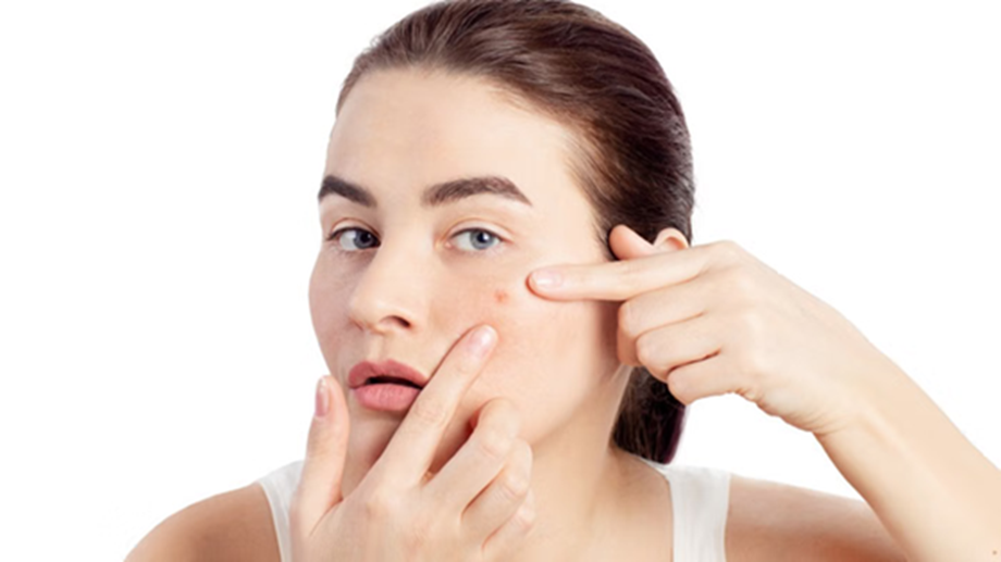 Pimple Popping: Give up the habit of popping pimples, otherwise your ...