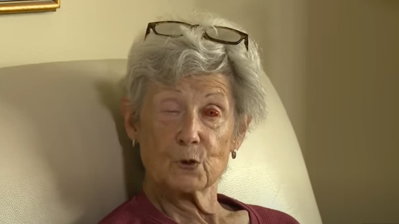 After A Decade, Blind Canadian Woman Sees Again Through Rare Tooth-in ...