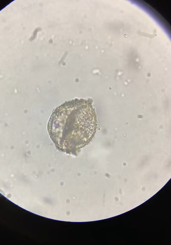 Little Spheres of Allergies Under the Microscope