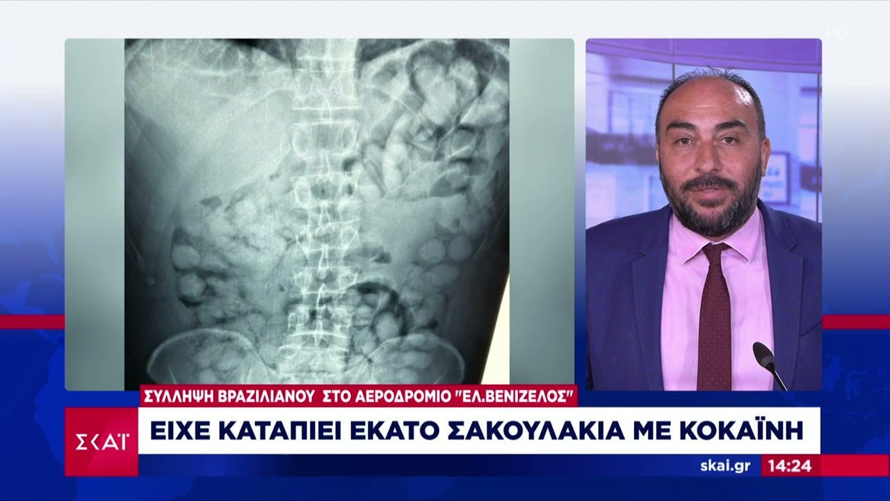 Σύλληψη Βραζιλιάνου στο αεροδρόμιο Ελ. Βενιζέλος: Είχε καταπιεί 100 ...