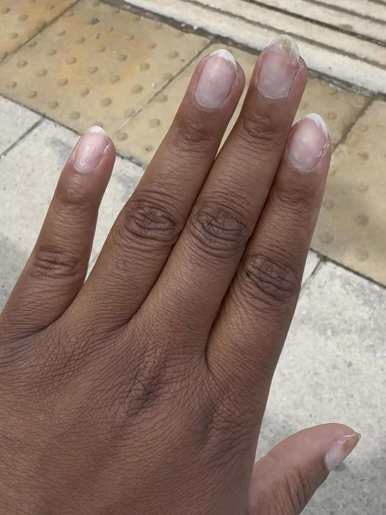 “Nail Greenies” Are The BIAB Side Effect No One Warned Me About