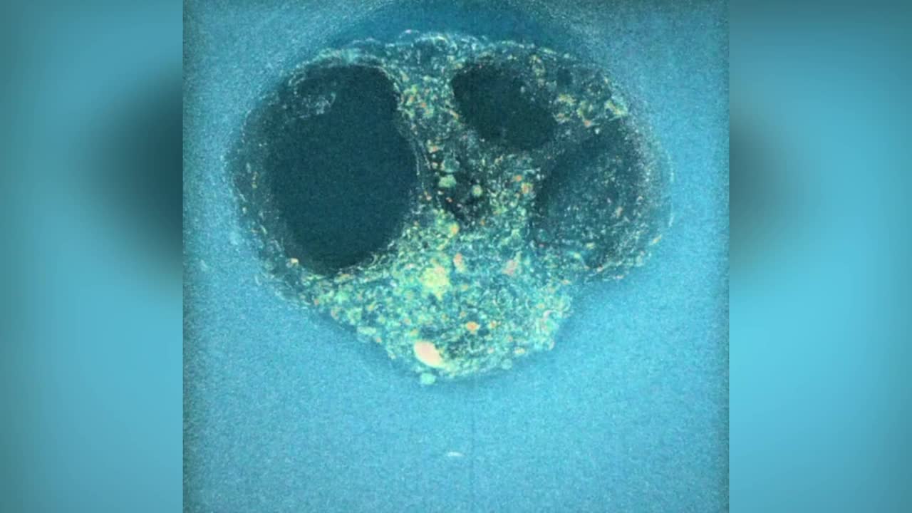Human embryo implantation captured in real-time by scientists